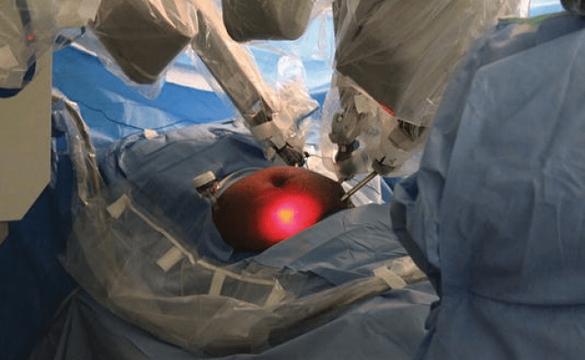 Robotic Transabdominal Preperitoneal Rtapp Ventral Hernia Repair Dr