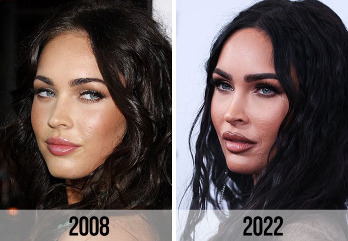 Fans Unhappy With Megan Fox Instagram Face After Reported Plastic