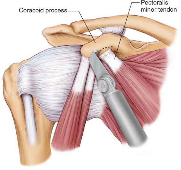 Chapter 15 Teachme Orthopedics