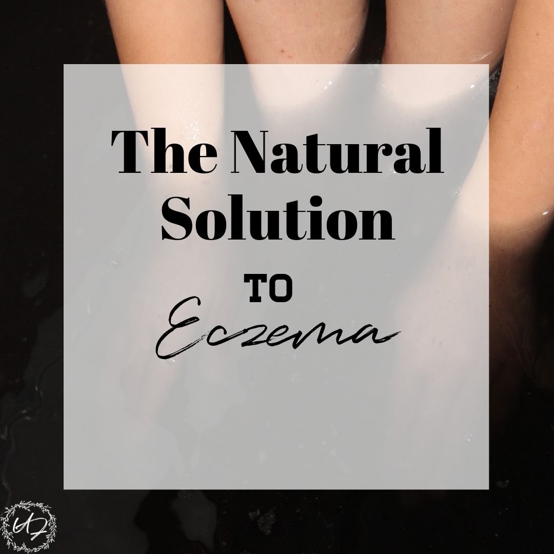 How To Get Rid Of Eczema Naturally The Easy Solution