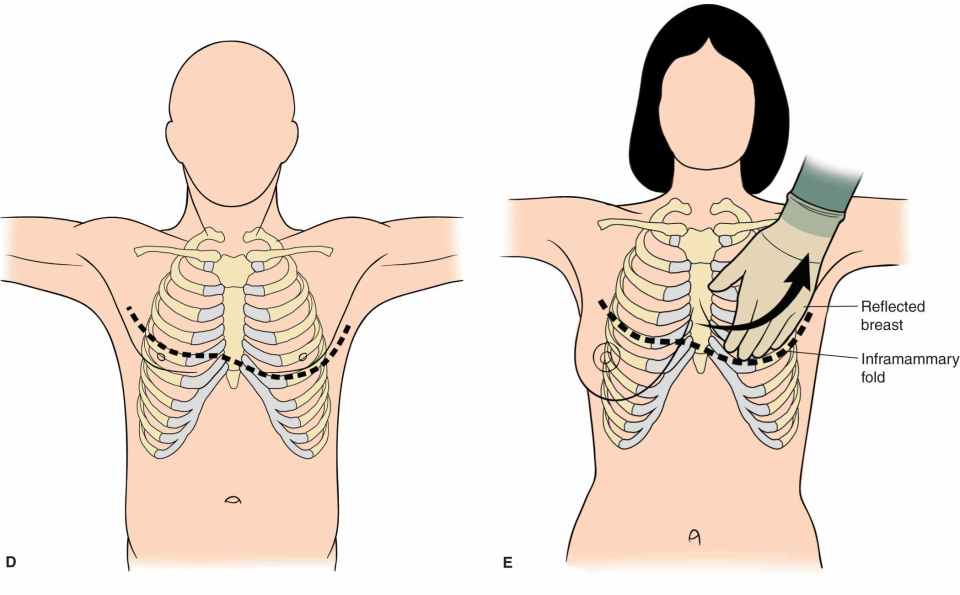 Outlet And Chest Thoracic Key