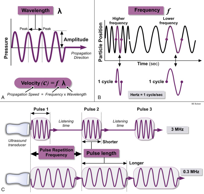 Physical Principles Of Ultrasound And Generation Of Images Thoracic Key