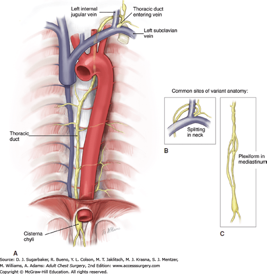 Surgical Management Of Chylothorax Thoracic Key