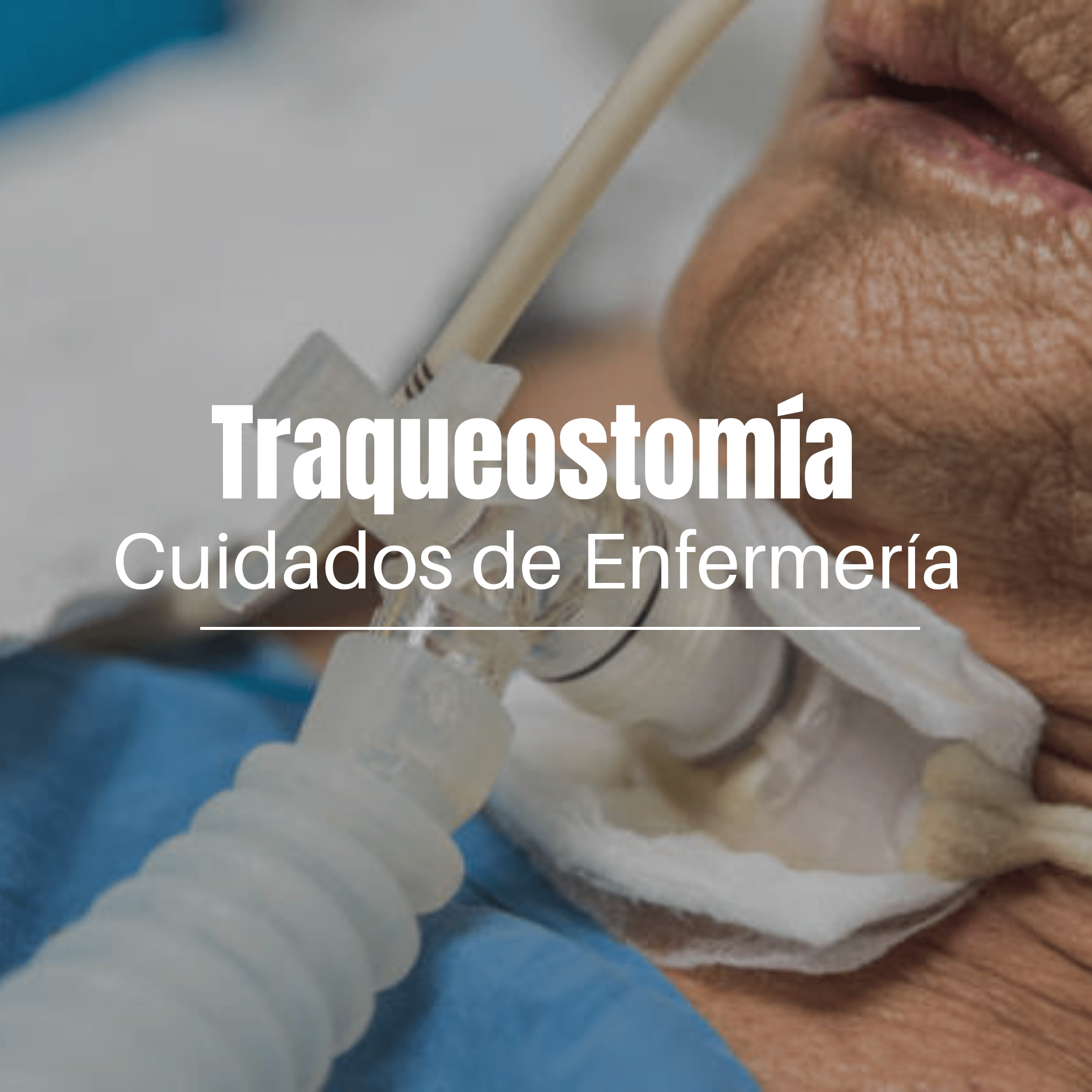 Traqueostomía Cuidados De Enfermería