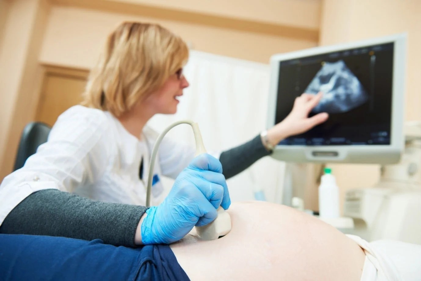 What Are The Different Types Of Ultrasounds Zobuz