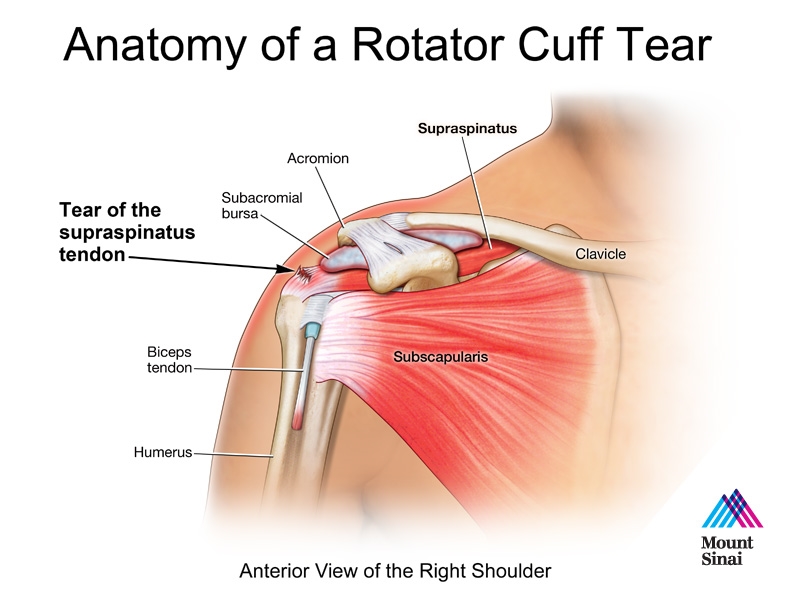 Rotator Cuff Problems Sports Medicine