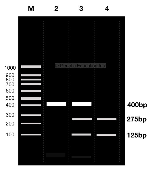 Part 2 Analysing And Interpreting Agarose Gel Electrophoresis Results