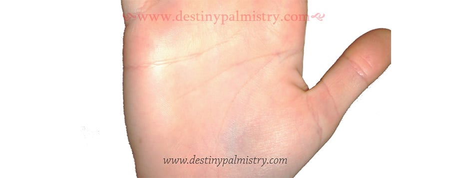 Healing Ability Signs In Hand Analysis Destiny Palmistry