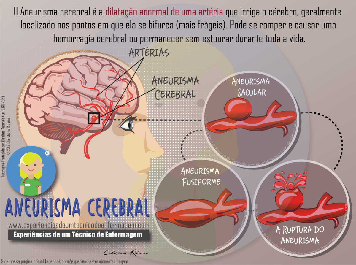 O Aneurisma Cerebral Enfermagem Ilustrada