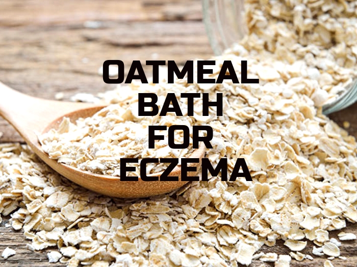 13 Proven Home Remedies To Get Rid Of Eczema Scars