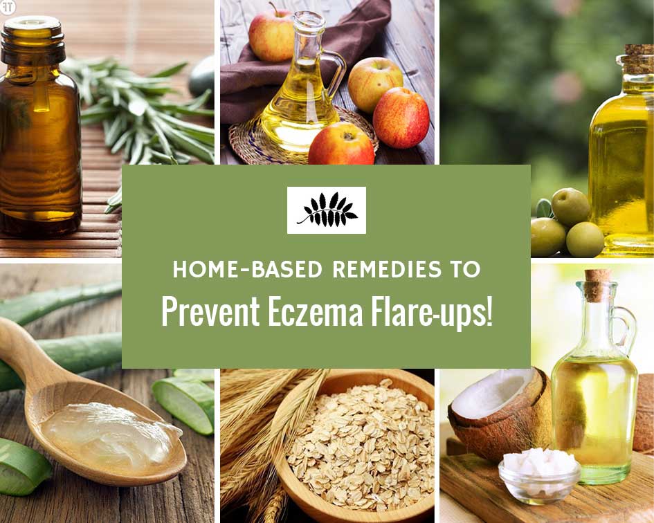 11 Home Remedies To Control Eczema Symptoms And Prevent Flare Ups