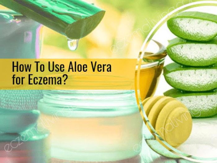 Eczema Itching Home Remedies And Tips To Get Relief