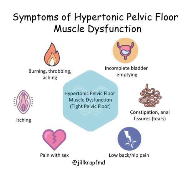 Hypertonic Pelvic Floor Muscles The Floors