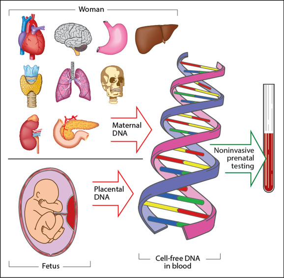 Noninvasive Prenatal Testing For Fetal Aneuploidy And Single Gene