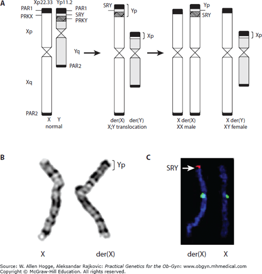 Disorders Of Sexual Differentiation Obgyn Key