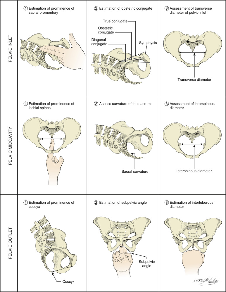 Normal Labor And Delivery Obgyn Key