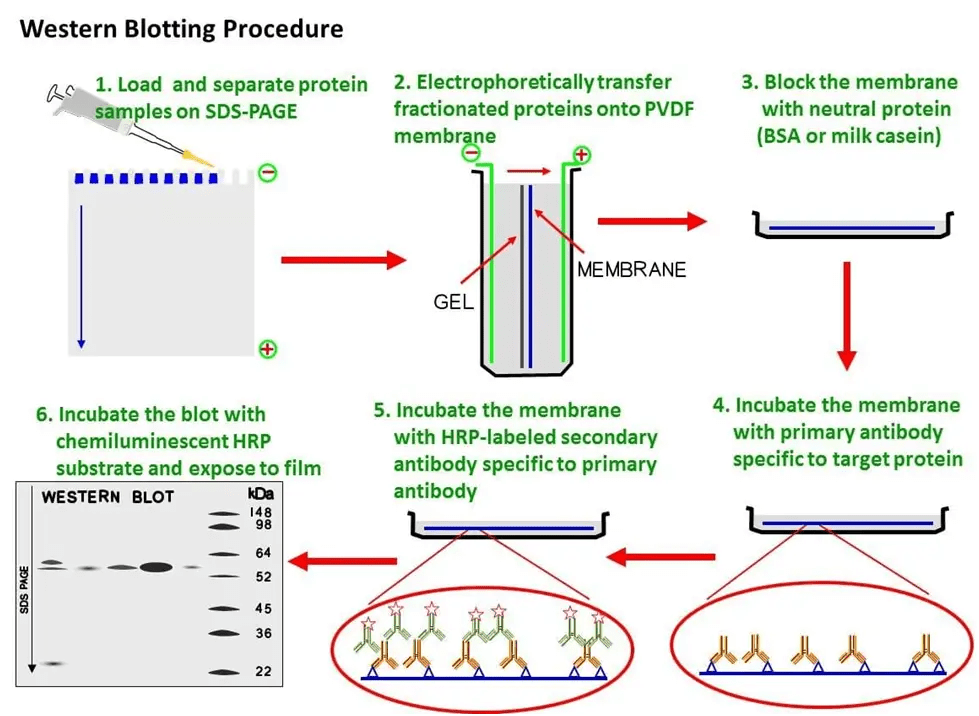 Western Blot Technique Principle Procedures And Uses Learn