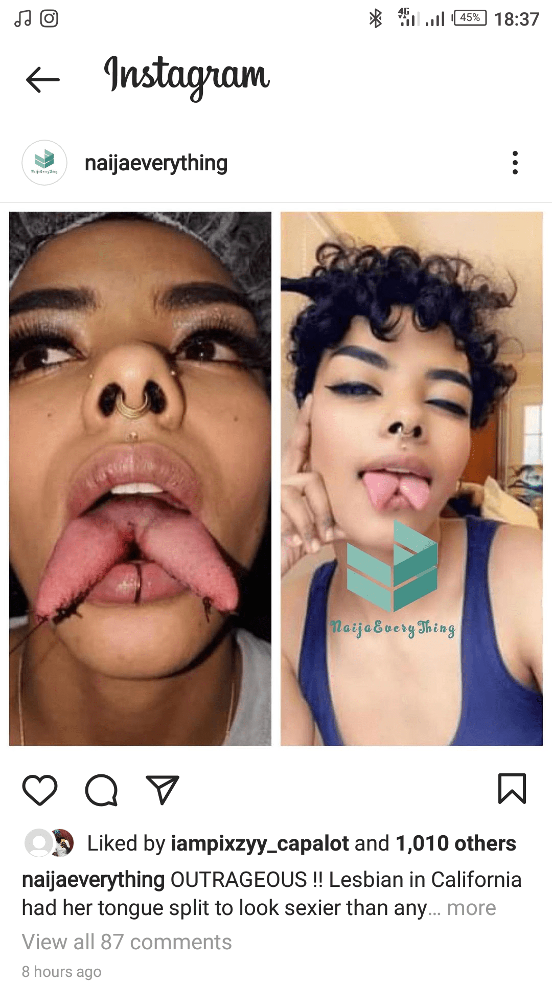 See Shocking Picture As California Lesbian Split Her Tongue To Look