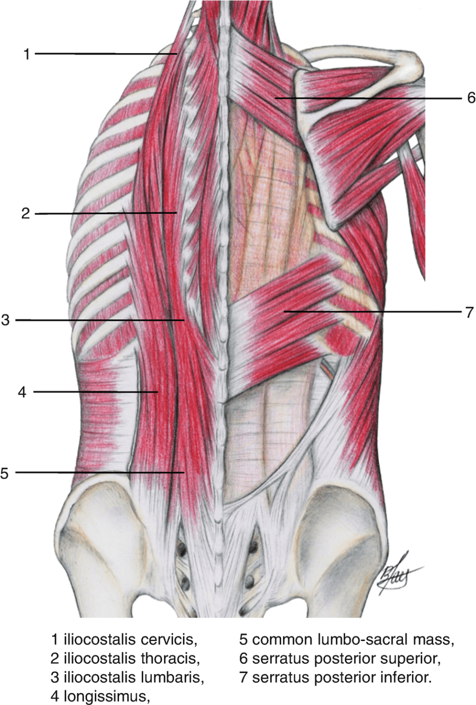 Normal And Pathological Spinal Muscle Musculoskeletal Key