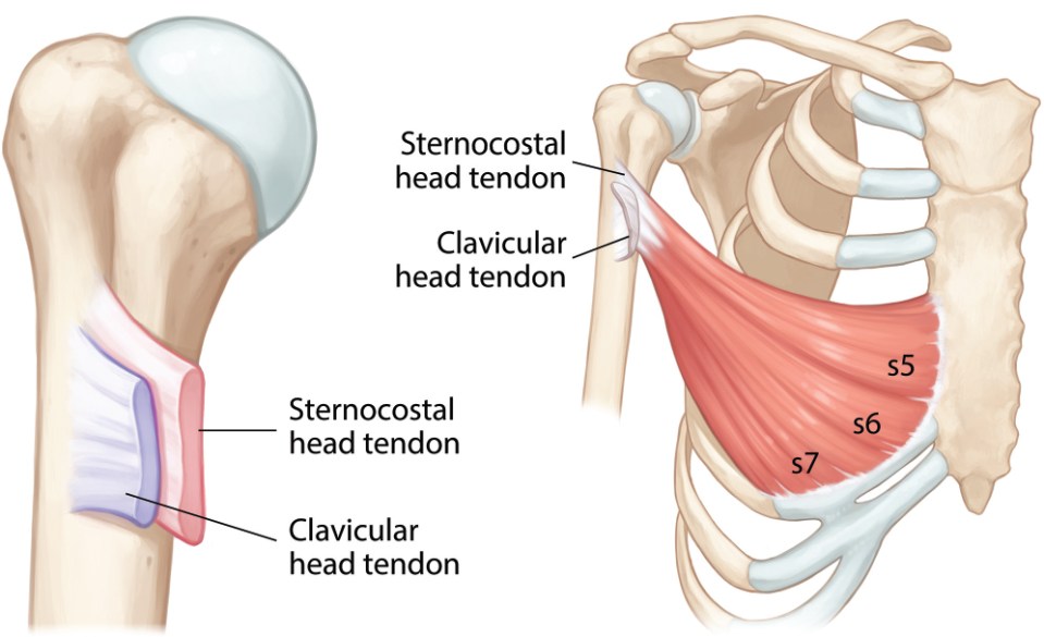 73 Pectoralis Major Repair Musculoskeletal Key