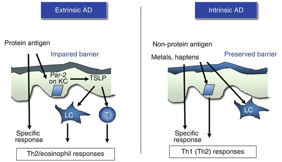 Extrinsic And Intrinsic Atopic Dermatitis Plastic Surgery Key