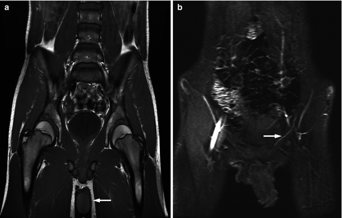 Principles Of Magnetic Resonance Imaging Mri Radiology Key