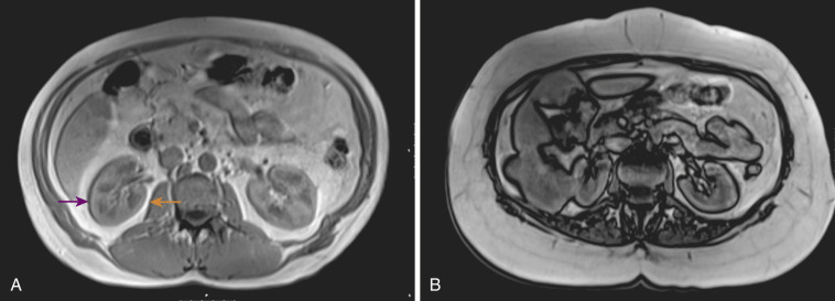 Imaging Principles In Magnetic Resonance Imaging Radiology Key