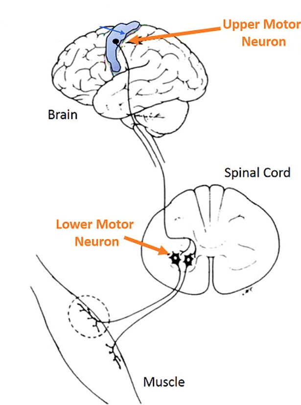 Upper And Lower Motor Neuron Lesions
