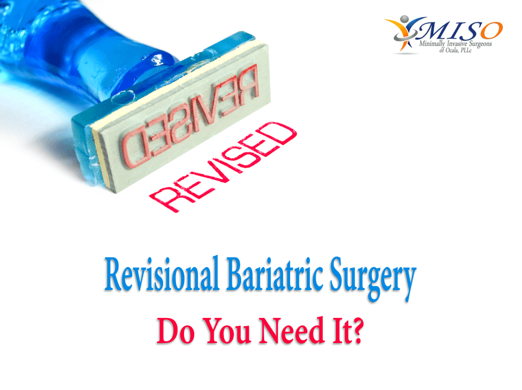 Revisional Bariatric Surgery Do You Need It Ocala