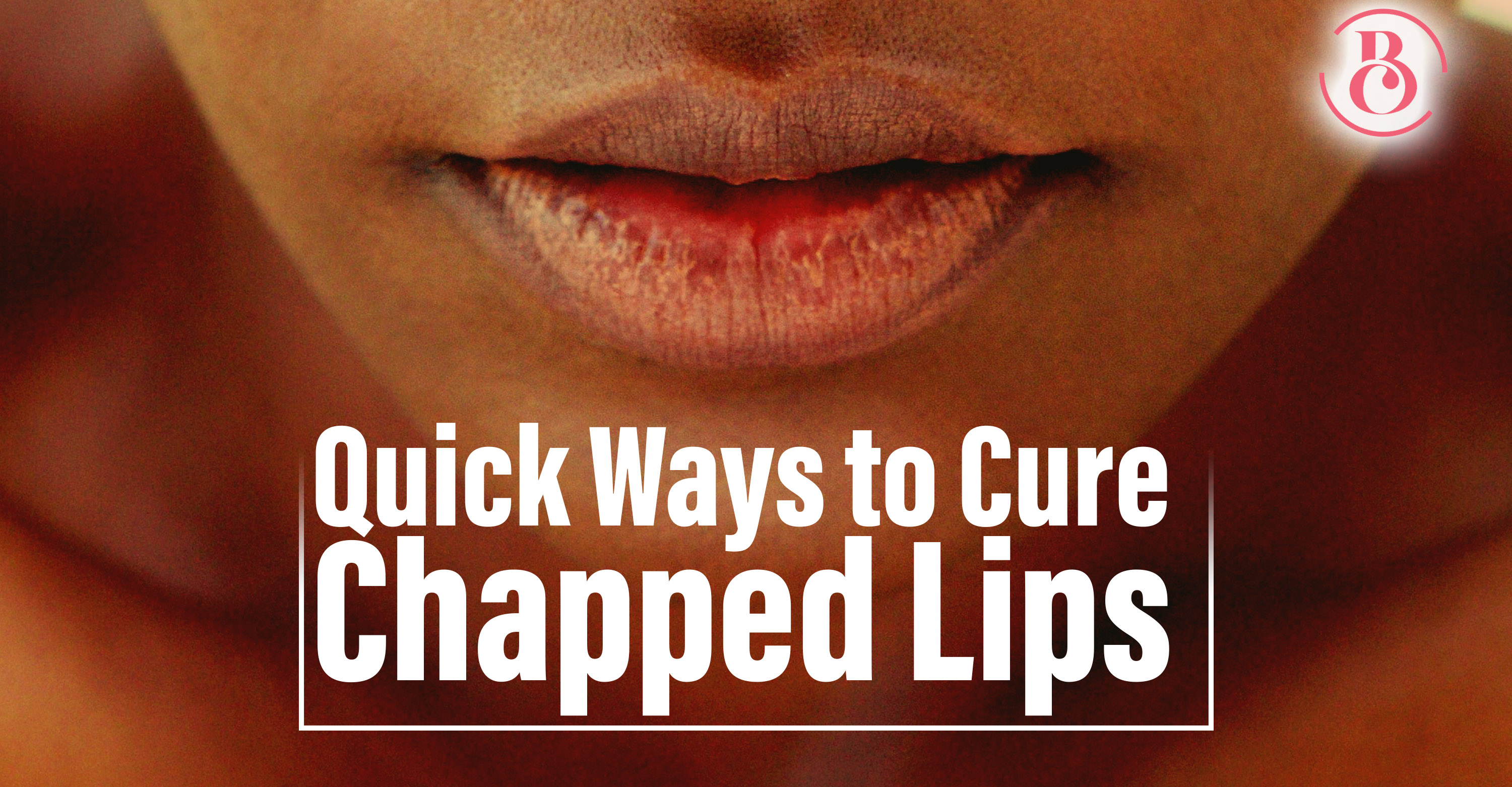 10 Quick Ways To Treat Chapped Lips Beaucrest