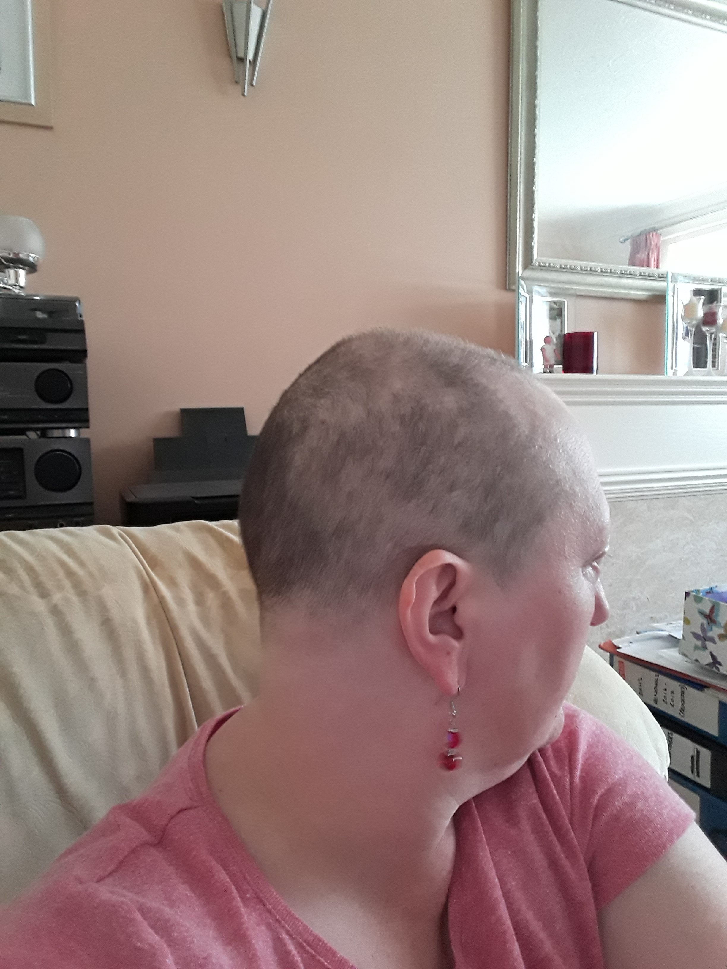 15 Hair Regrowth After Chemo Pictures Ideas Endaily