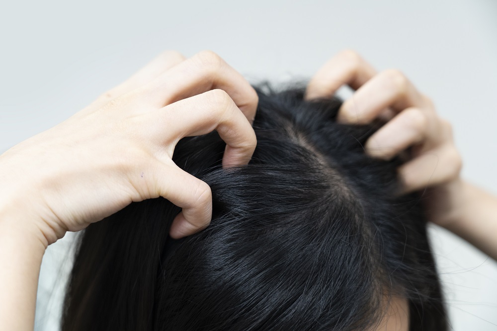 How To Cure Dry Scalp At Home Redorbit