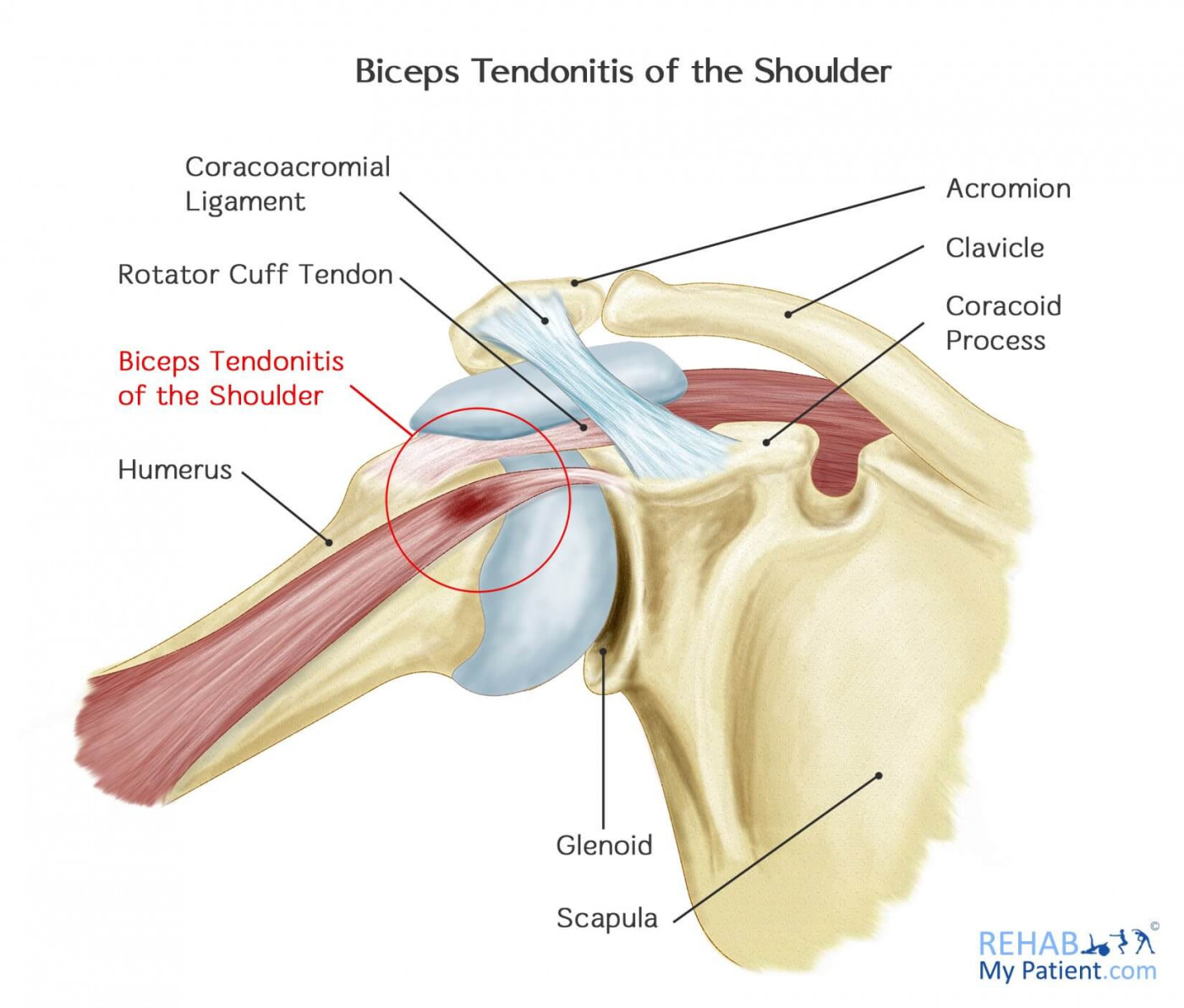 Shoulder Tendons Chart Posterior View Of The Shoulder Shoulder Muscle