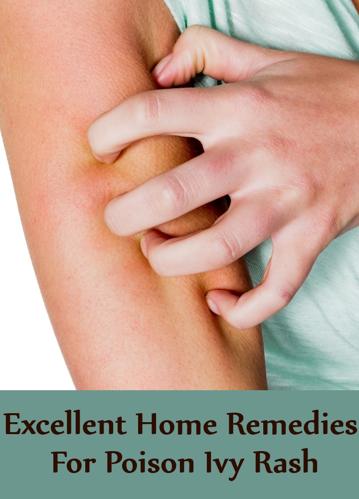 11 Excellent Home Remedies For Poison Ivy Rash Search Home Remedy