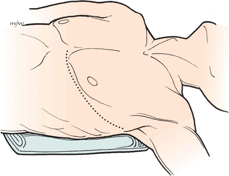 Lung Trachea And Esophagus Thoracic Key