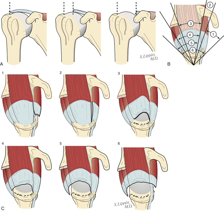 The Rotator Cuff Thoracic Key