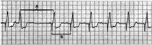 Cardiac Catheterization And Hemodynamic Assessment Thoracic Key