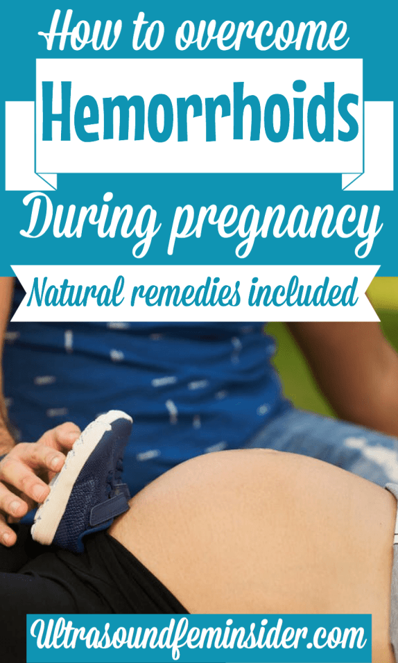 Hemorrhoids During Pregnancy How To Prevent And Treat Them