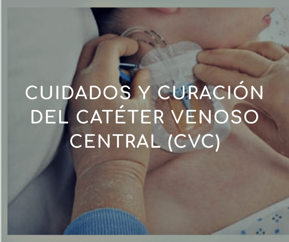 Catéter Venoso Central Cuidados Y Curación