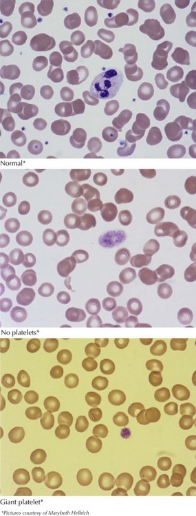 Platelet Disorders Clinical Gate