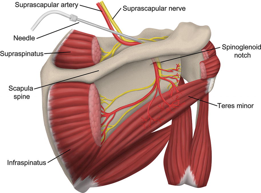 Nerve Anesthesia Key