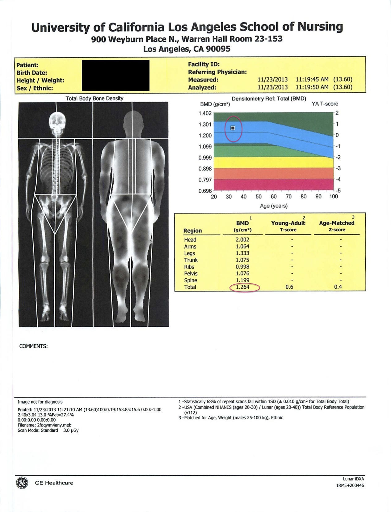 My Dexa Scan For Body Composition Bjj Caveman