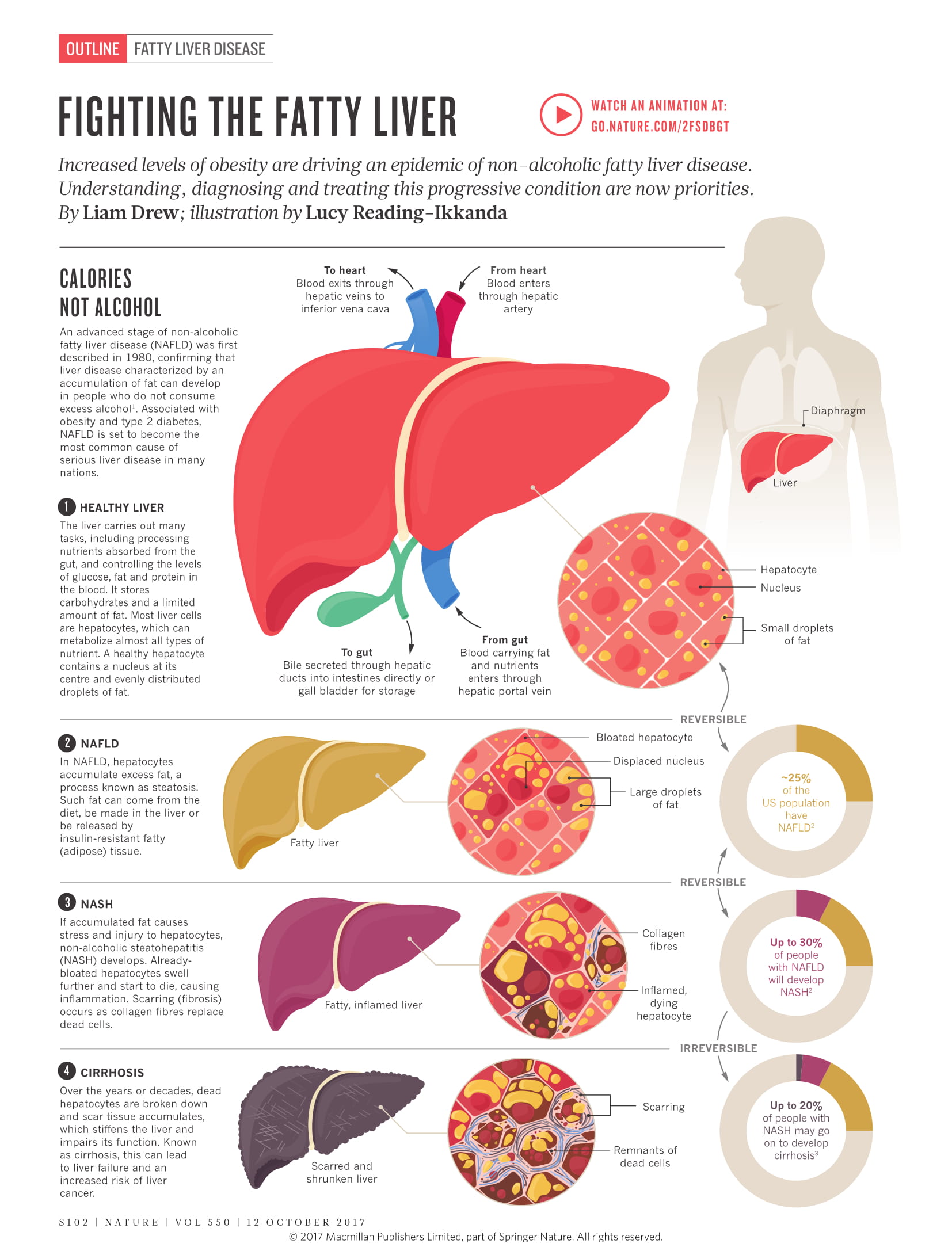 Understanding Fatty Liver Disease And Its Treatment Protocol Infographic