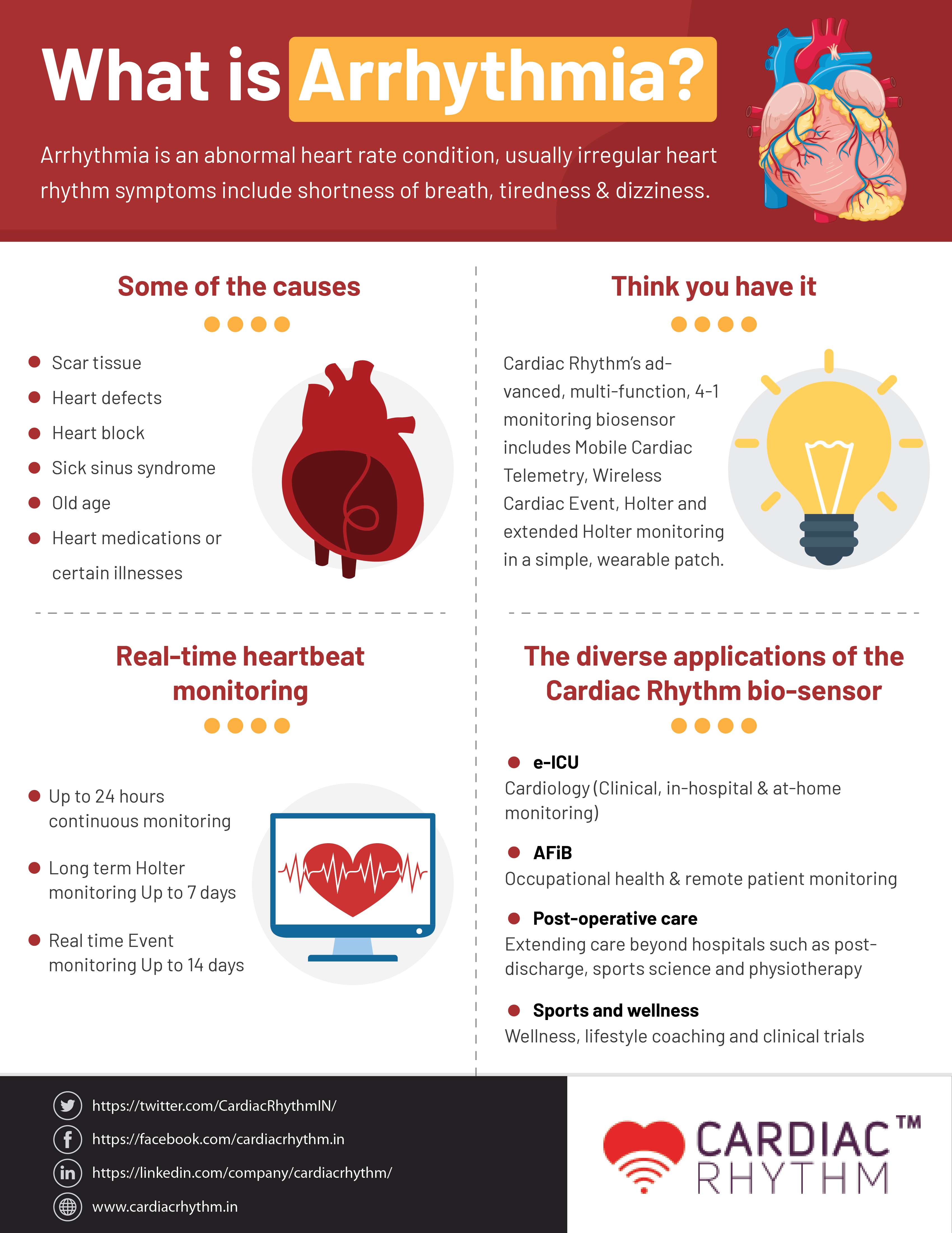 Everything You Want To Know About Arrhythmia A Quick Guide Infographic