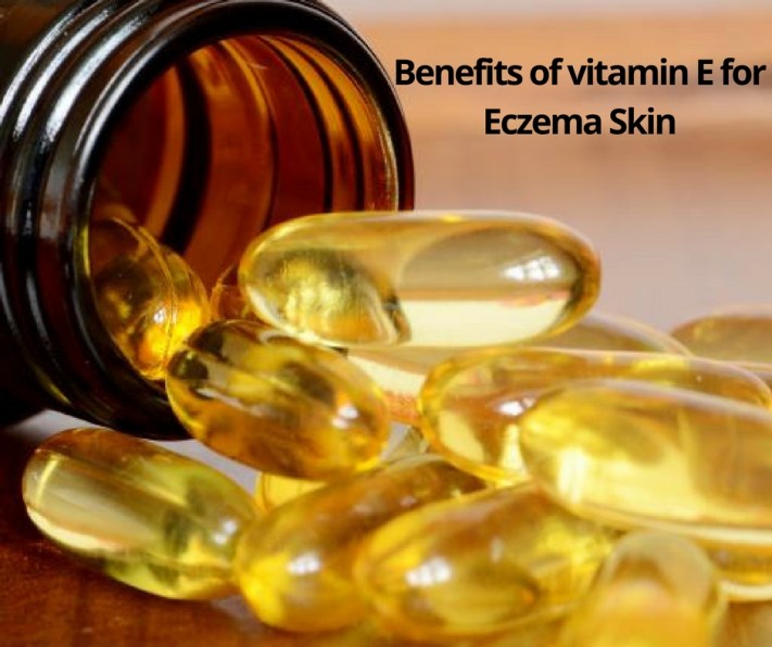 Vitamins And Supplements To Treat Eczema Eczemaliving