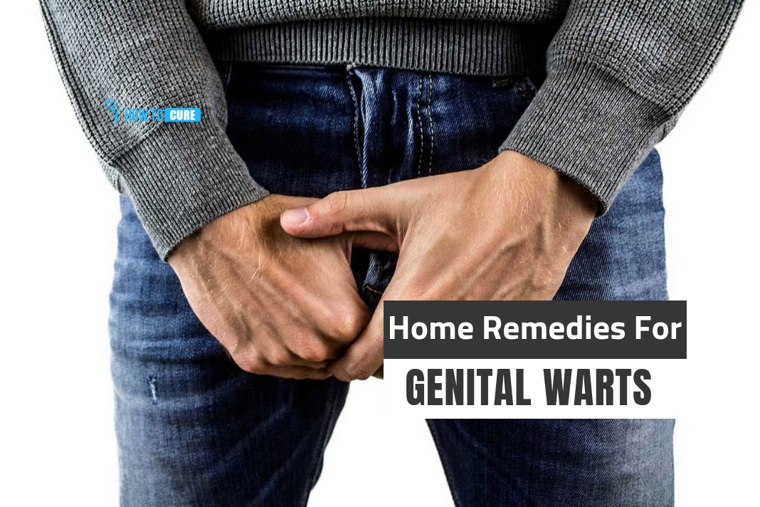 5 Proven Home Remedies For Genital Warts How To Cure