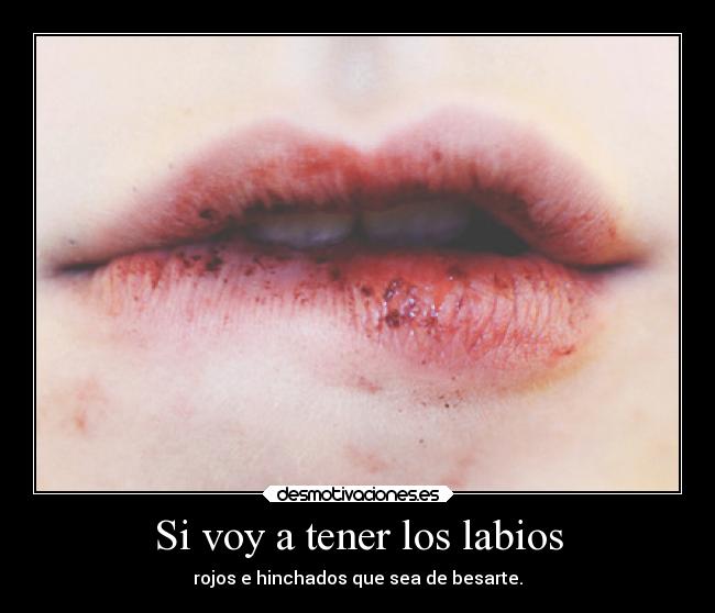 8 Memes Labios Hinchados References Labios Tatuados Letra