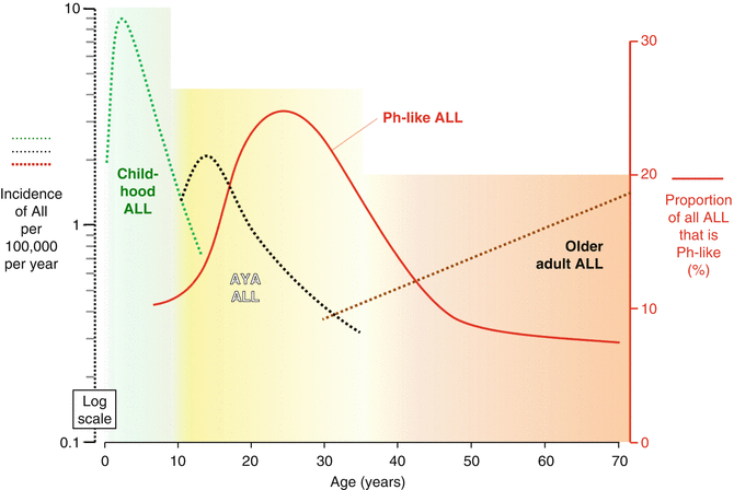 Acute Lymphoblastic Leukemia Oncohema Key