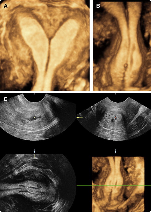 Consider Ultrasound First For Imaging The Female Pelvis Obgyn Key