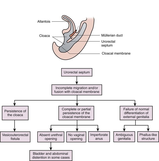 Disorders Of Sex Development Obgyn Key